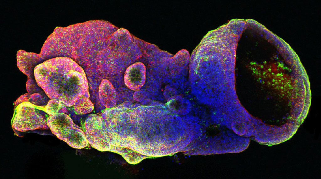Goblet cells in adult human descending colon organoids - London Stem ...